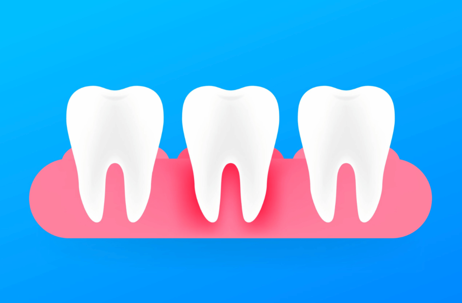 Can You Reverse Gum Disease? | Calgary | Skypointe Dental